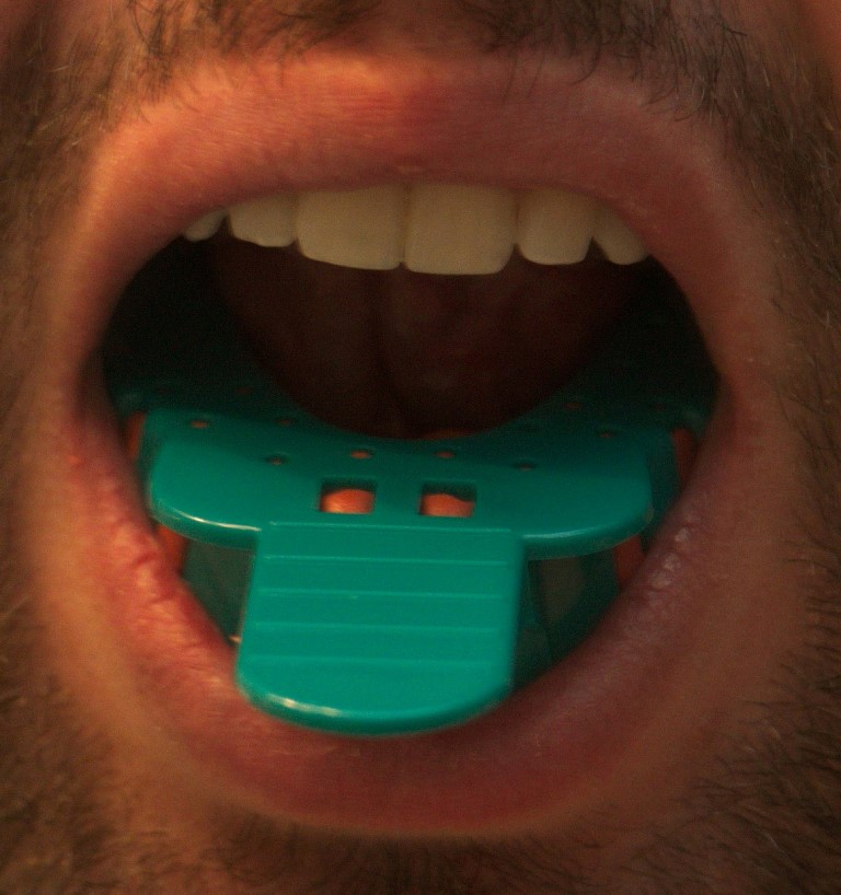 Dental Self Impression Guide and Tips | The Healthy Mouth Project